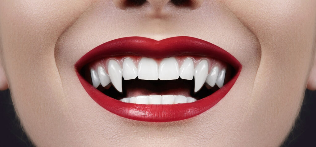Your Ultimate Guide to Sourcing Vampire Teeth Dental